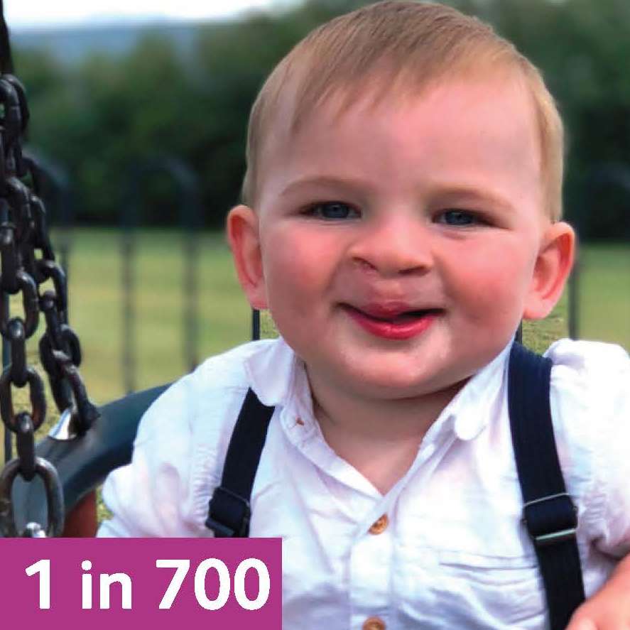 Cleft Lip & Palate Association