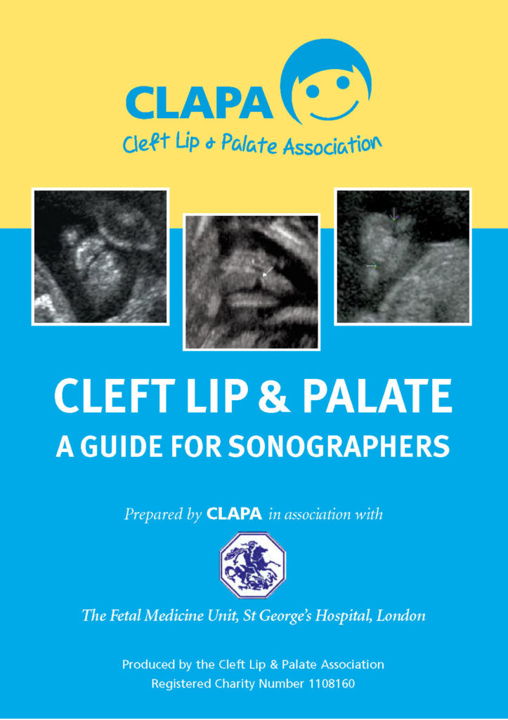 Cleft Lip & Palate Association