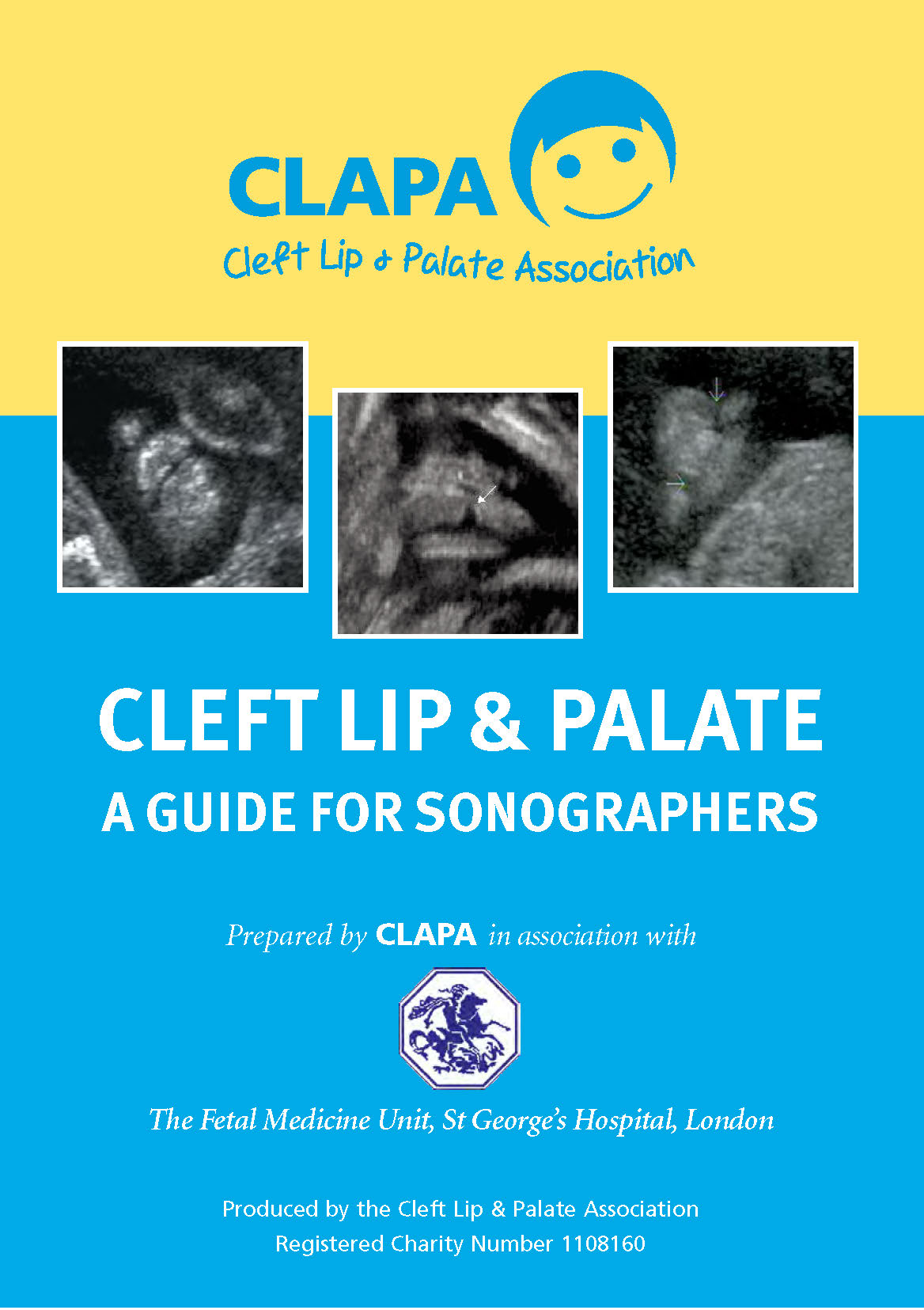 Cleft Lip & Palate Association