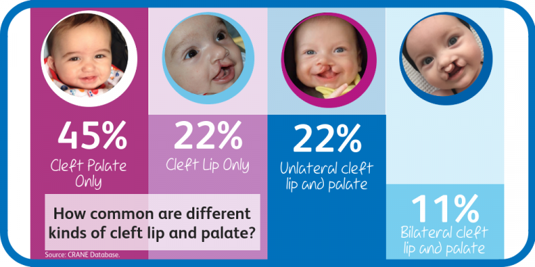 Cleft Lip & Palate Association