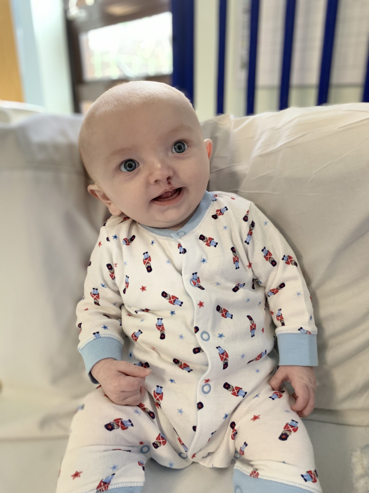 2 days post operation