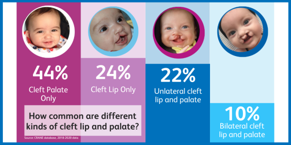 Cleft Lip & Palate Association
