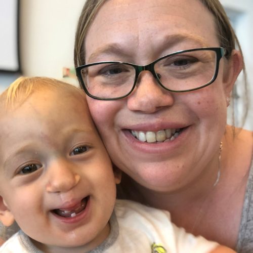 Cleft Lip & Palate Association