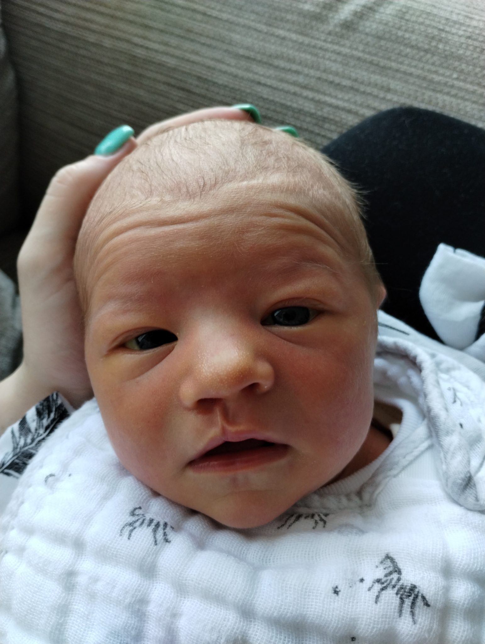 Cleft Lip & Palate Association